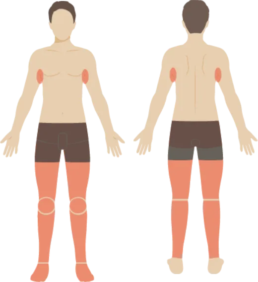 栃木県小山市のVIO脱毛ならMen's アルカ